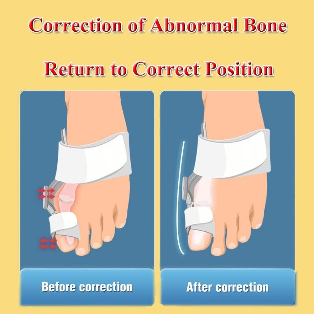 Adjustable GYLRD Big Toe Straightener & Bunion Corrector for Men and ...