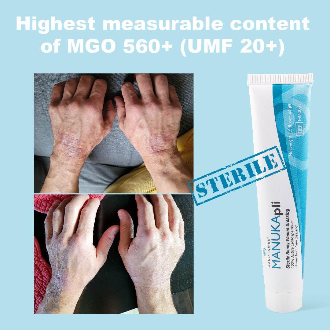 ManukaMed MANUKApli Sterile Wound Dressing with Pure Medical Manuka ...