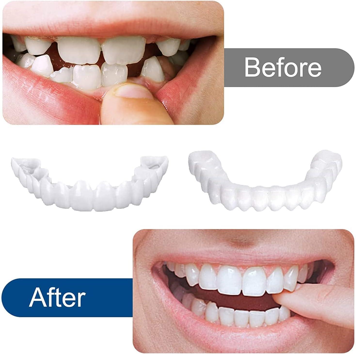 Buy 2 Pairs Instant Veneers - Upper & Lower Snap-On Fake Teeth for a ...