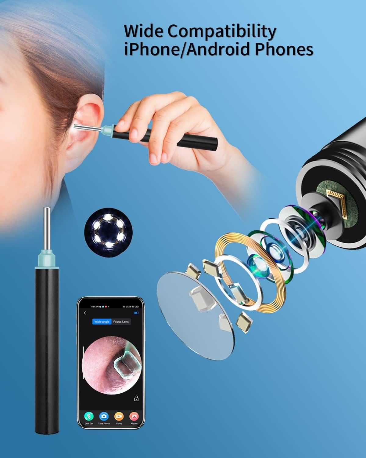 Healuck Electric Ear Wax Removal Kit | Professional Ear Irrigation ...