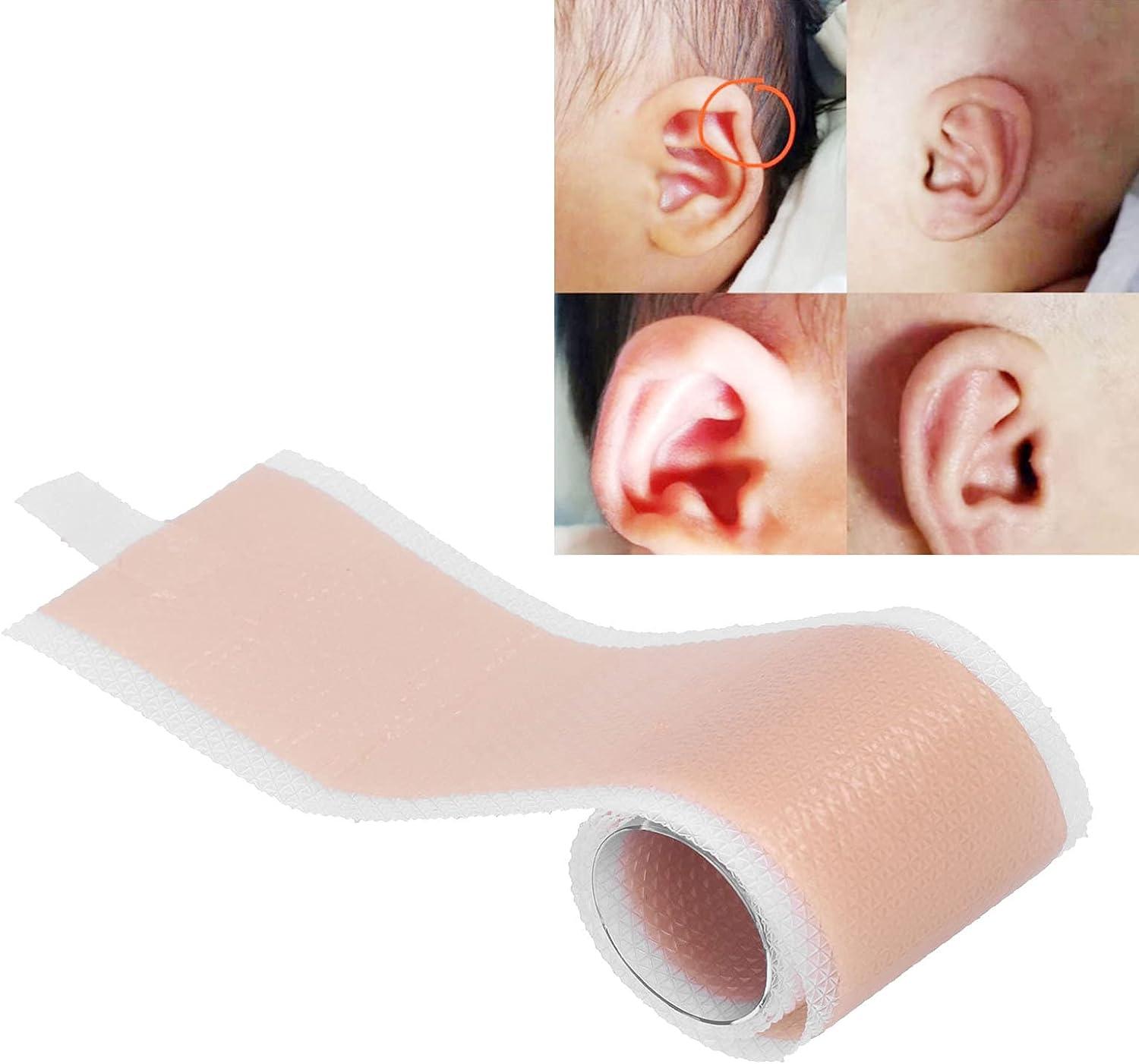 Silicone Baby Auricle Valgus Correction Patch - Infant Protruding Ear ...