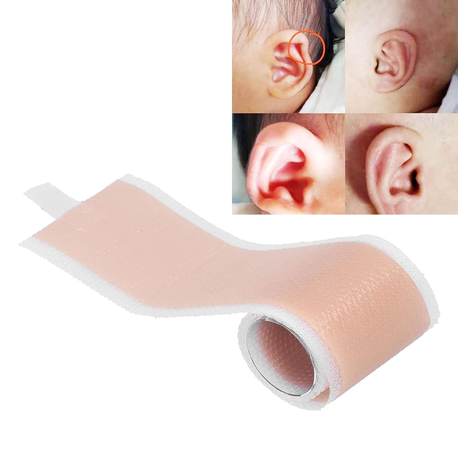 Newborn Protruding Ear Aesthetic Corrector - Ear Patch Stickers for ...