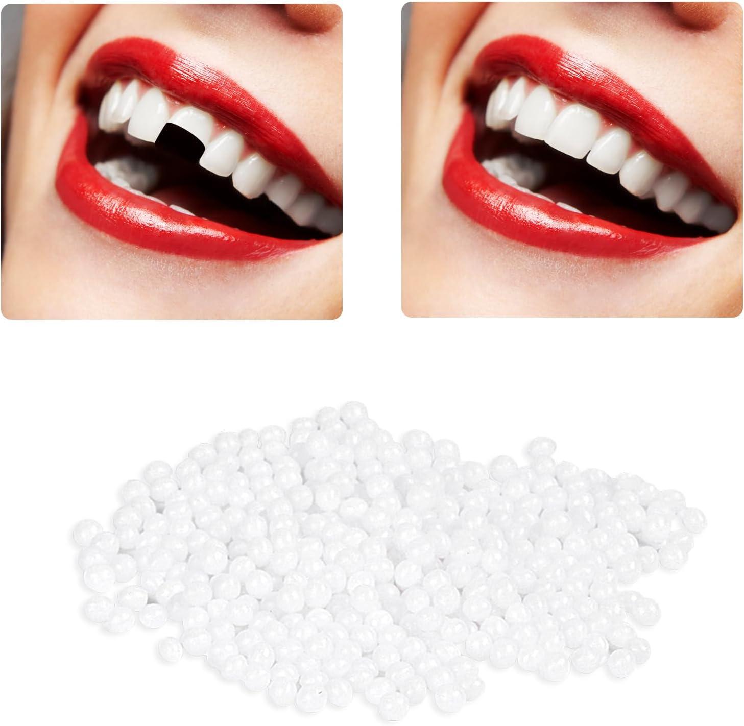 ACWOO Temporary Tooth Repair Kit 50g - Dental Filling Material for ...