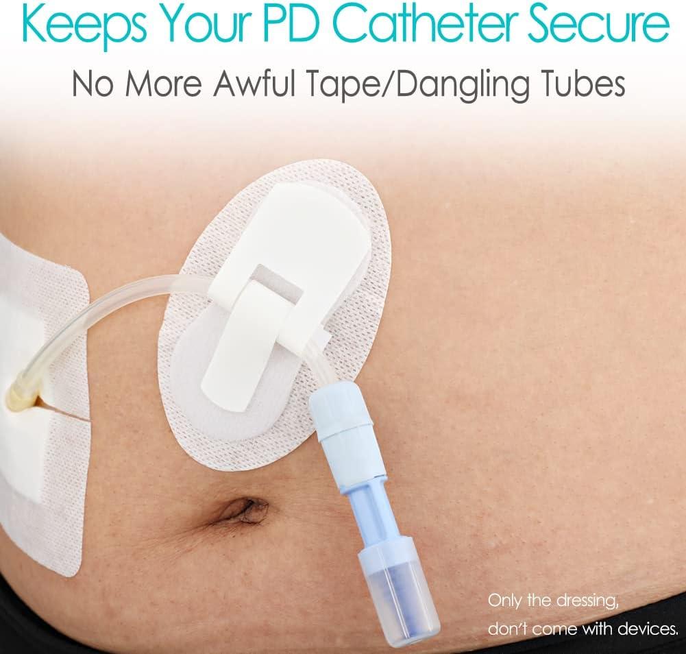 Peritoneal Dialysis PD Catheter Holder Adhesive Patch | Stabilization ...