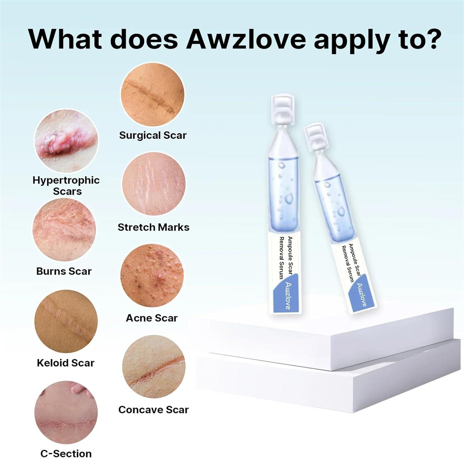 CRusio Awzlove Ampoule Scar Removal Serum - Remove New Scars in 3 Weeks ...