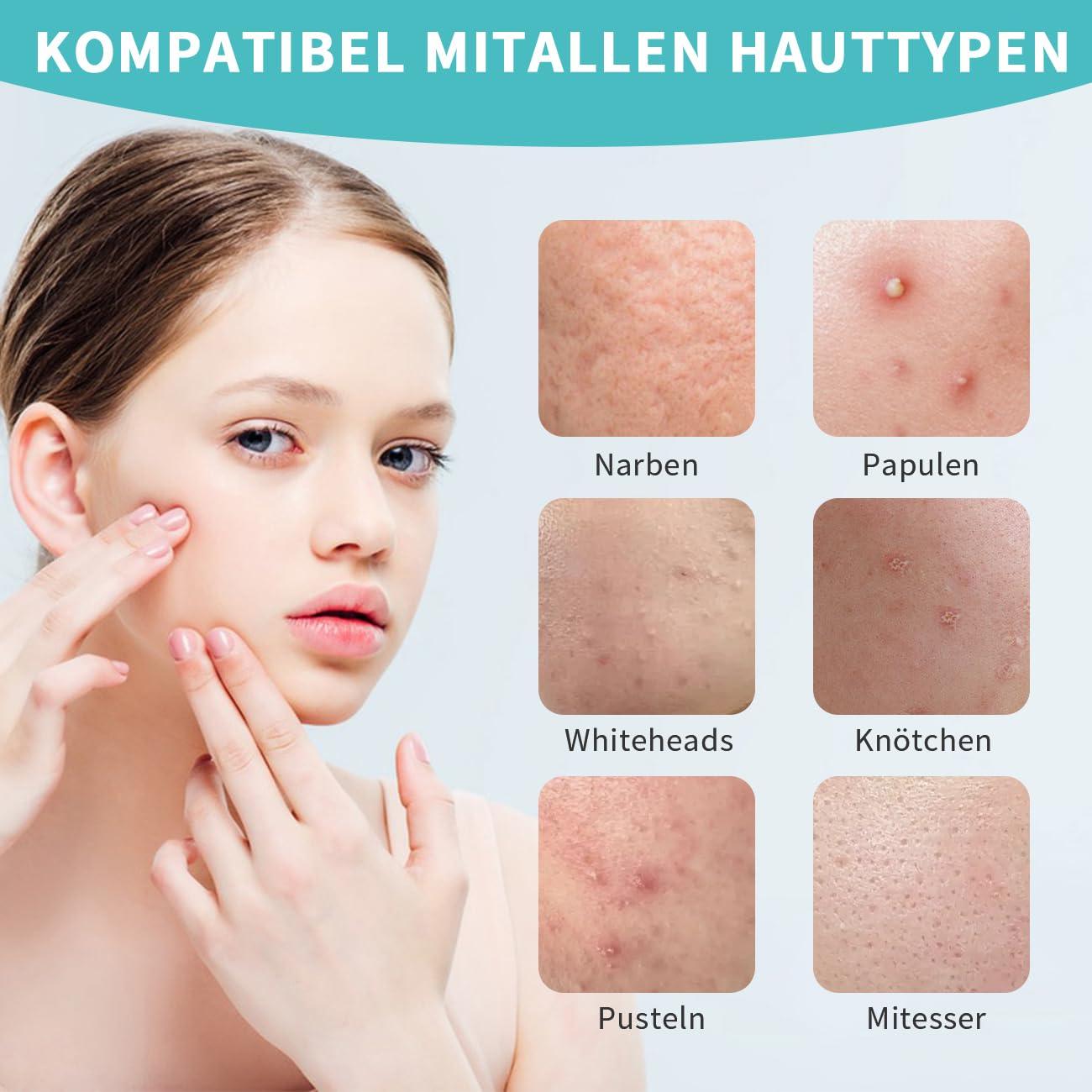 Day & Night 2-in-1 Waterproof Pimple Patches | Anti-Acne with Tea Tree ...