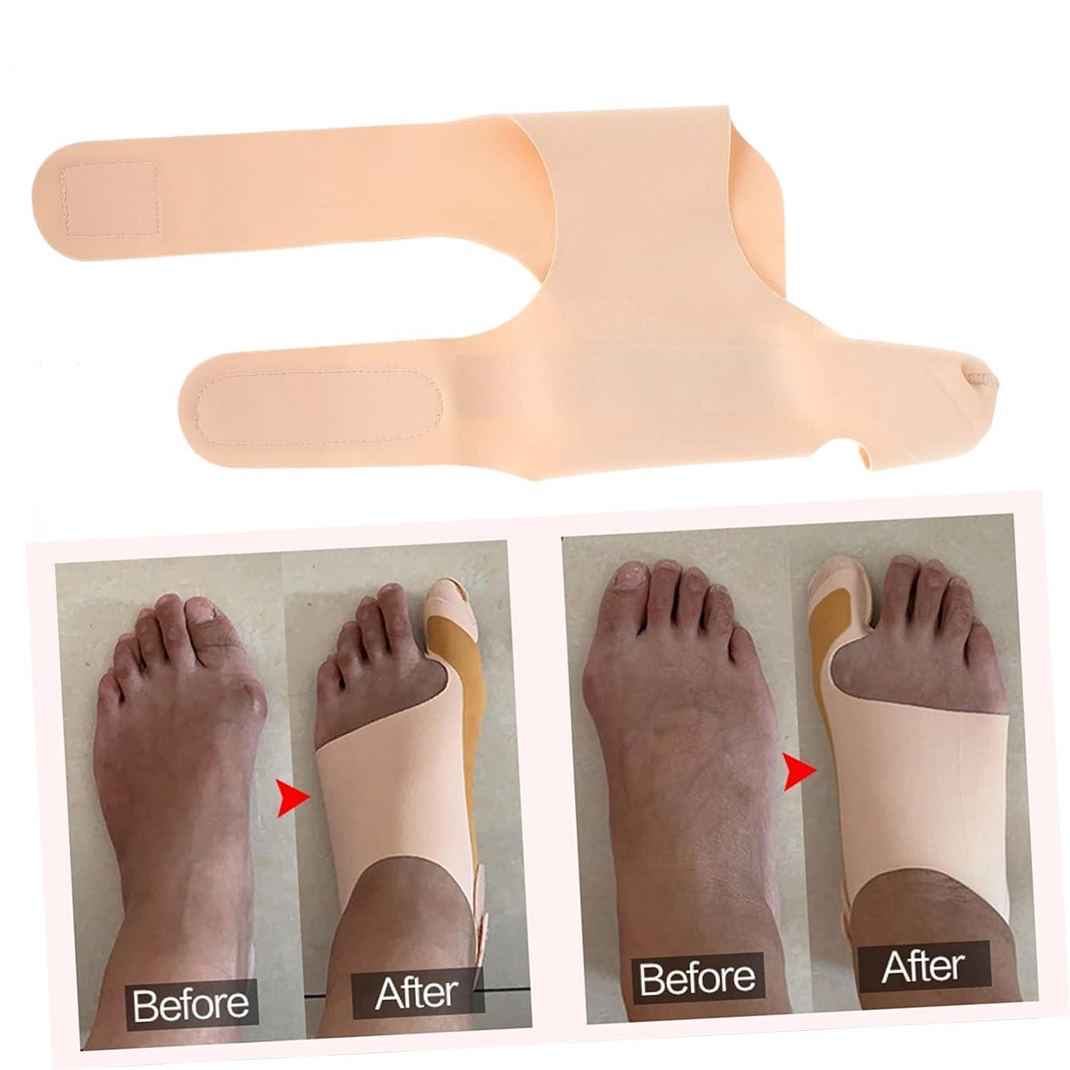 Lurrose Thumb Splint: Bunion Straightener & Joint Brace for Valgus ...