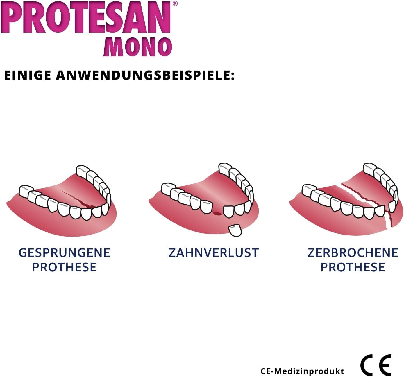 Protesan Mono - Ultimate Denture Repair for Broken Cracked or Missing ...