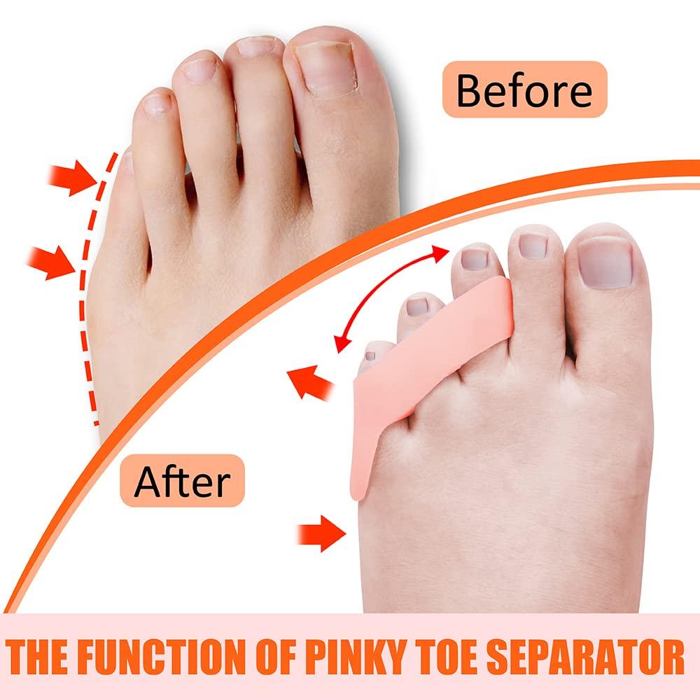 Pesalmon 8-Pack Pinky Toe Separators for Overlapping Toes - Gel Little ...