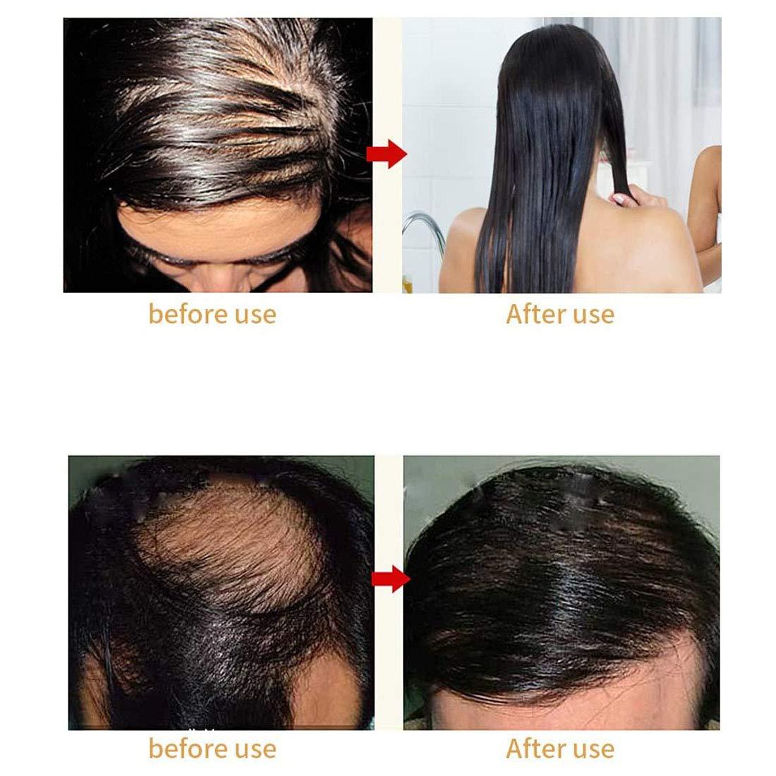 Qwaszx Electric Growth Comb - Anti-Hair Failure & Scalp Health | USB ...