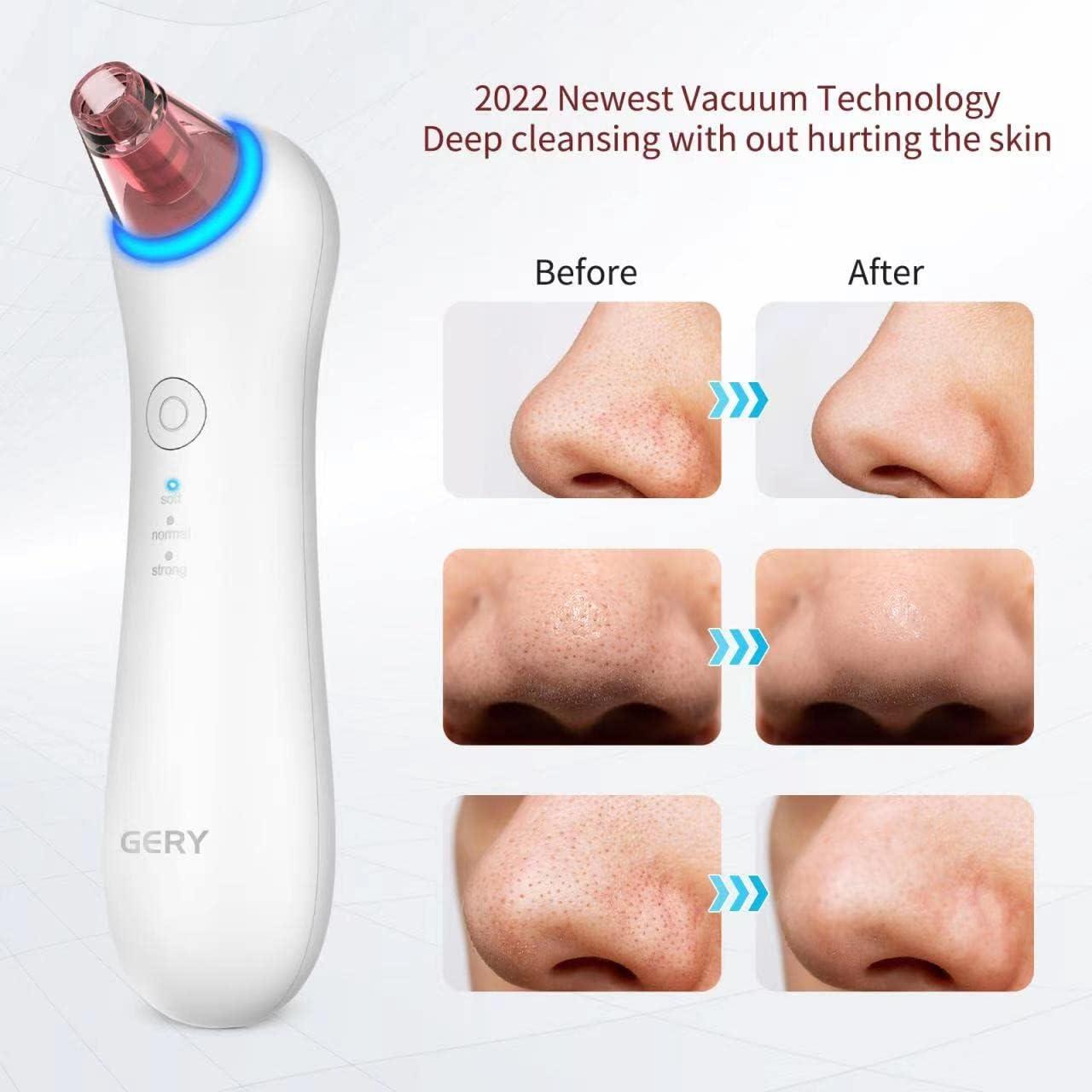2023 Newest GERY Blackhead Remover Pore Vacuum Extractor Kit | Facial & Nose Peel Tool with Red ...