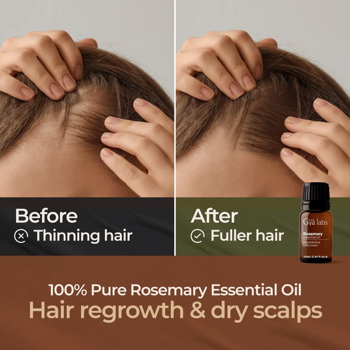 Gya Labs 100% Pure Rosemary Oil for Hair Growth & Dry Scalp - 0.34 fl ...