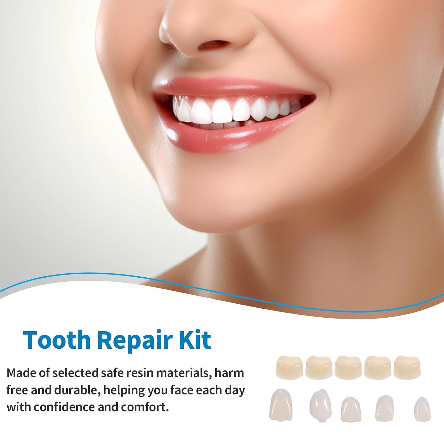 Temporary Tooth Caps & Crowns - Dental Repair Veneers for Front & Molar ...