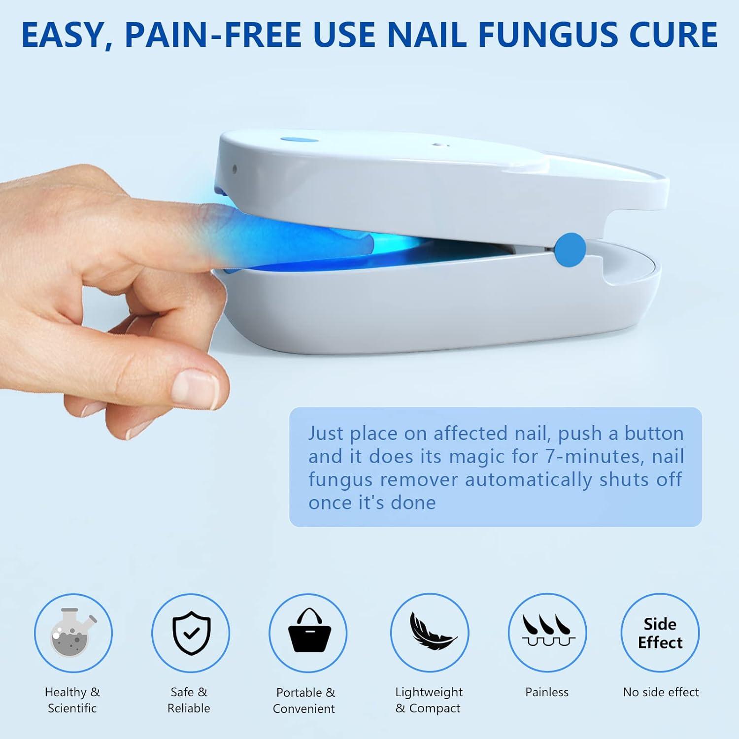 Nail Fungus Cleaning LaserDevice for Onychomycosis Revolutionary Home ...