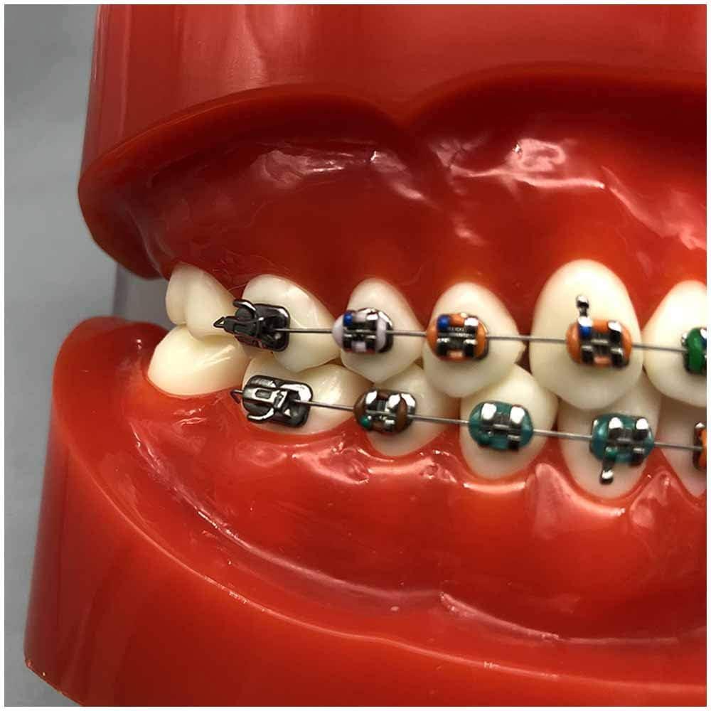 Orthodontic Teeth Model Dental Typodont With Metal Brackets Ligature