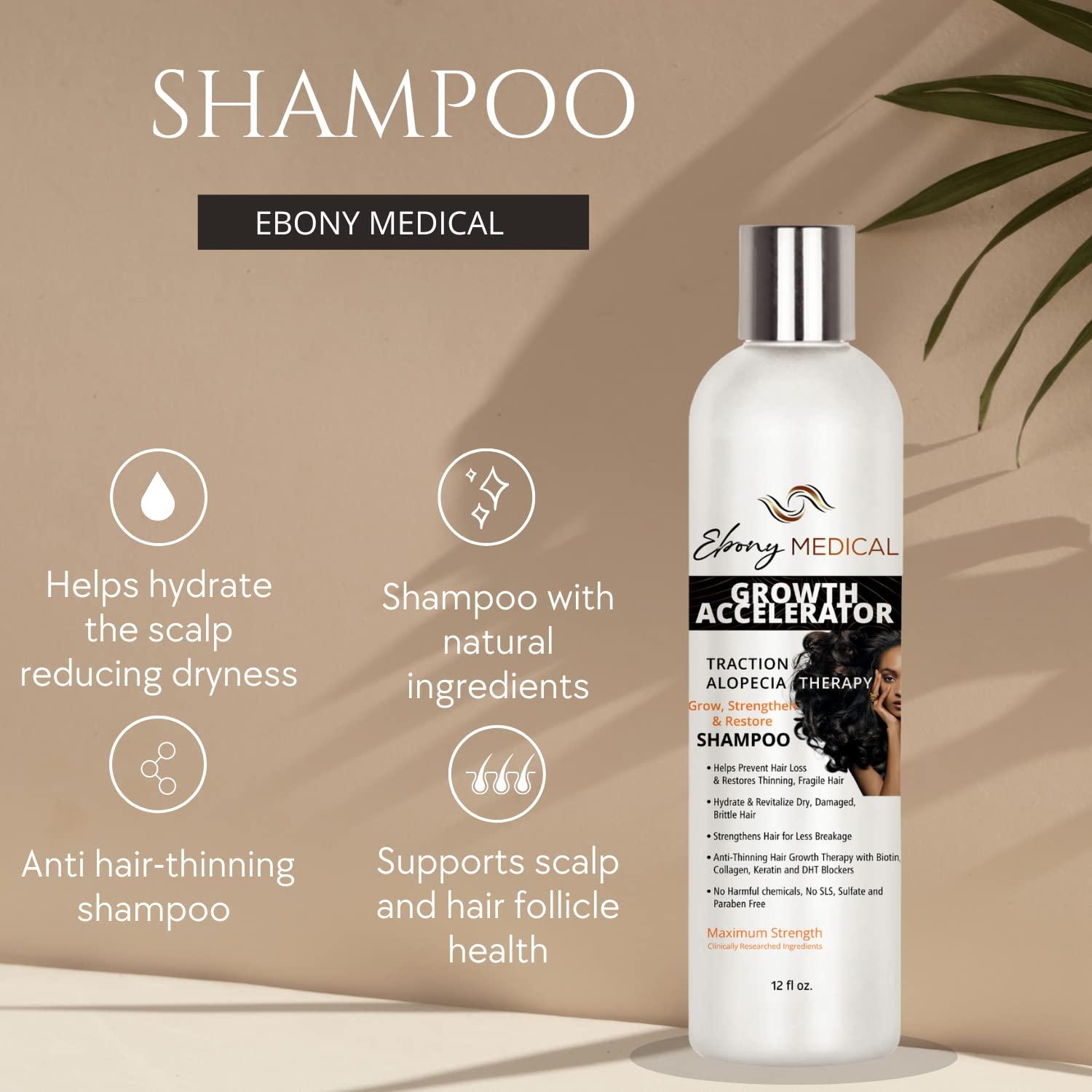Alopecia Areata Treatment Hair Loss Shampoo - Best Hair Growth Solution ...