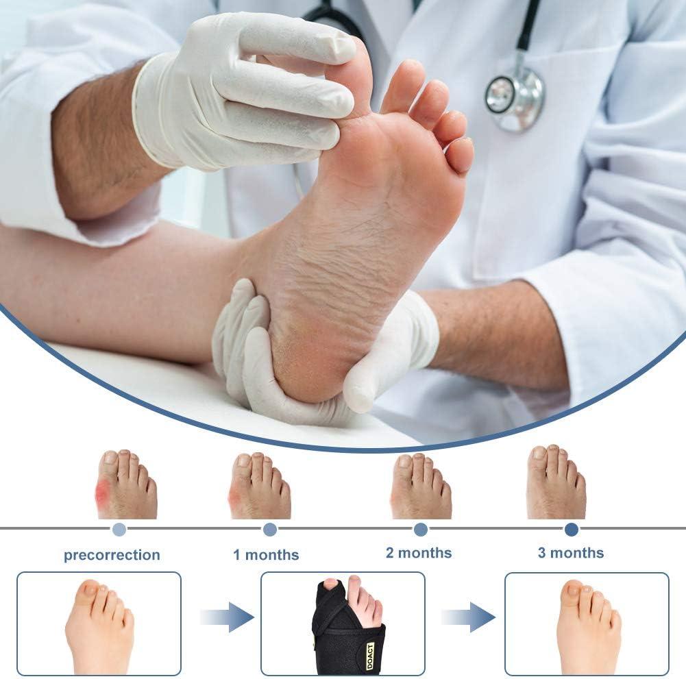 Bunion Corrector: Adjustable Orthopedic Toe Straightener for ...