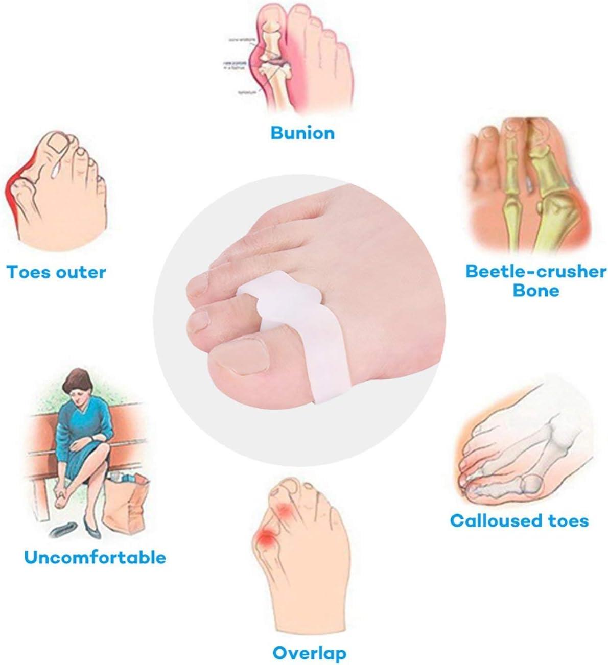 PEDIMEND Double Loop Toe Separator | Bunion Protector | Toe Separator ...