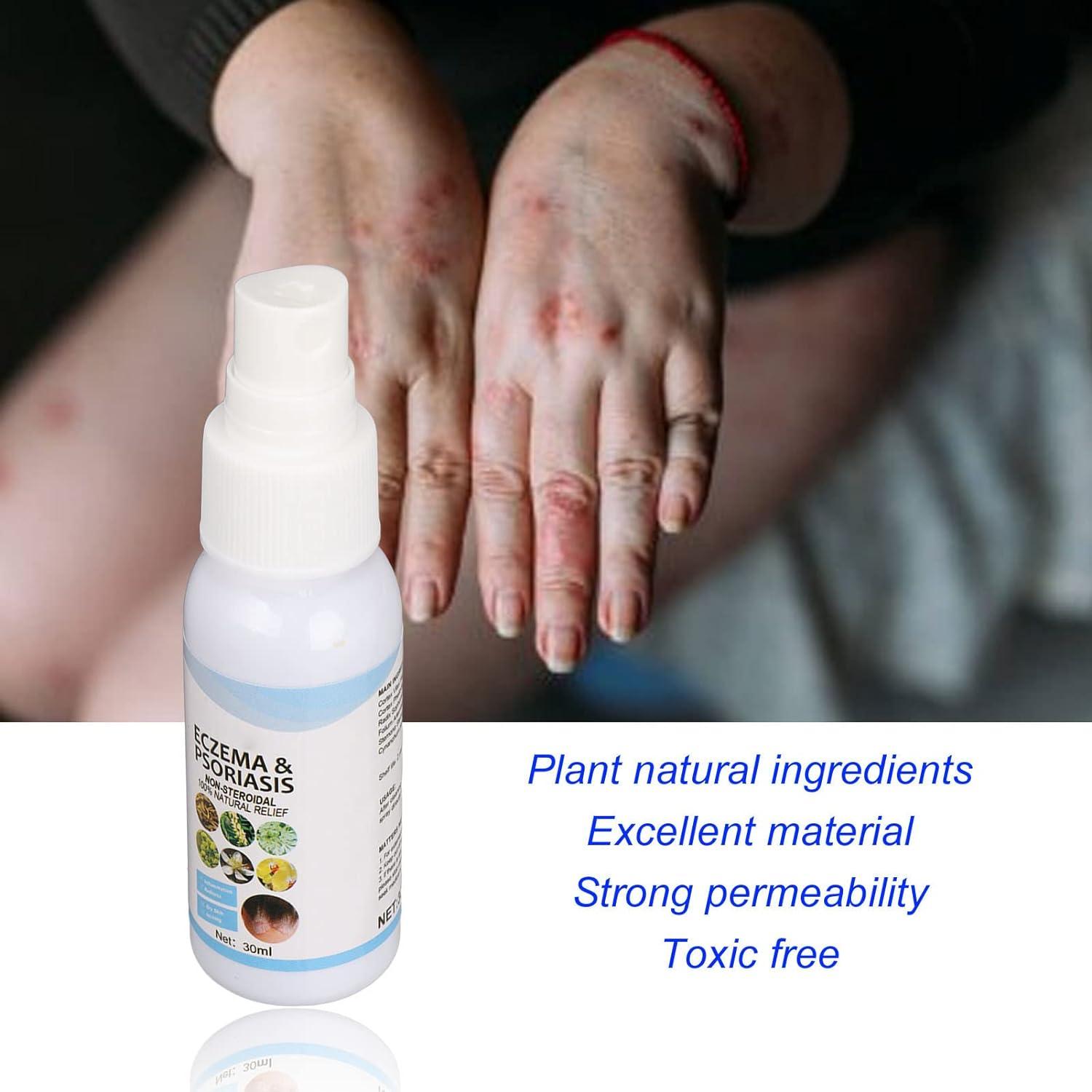 Itching Relief Spray 30ml Natural Enhance Skin Immunity Stop Itching ...