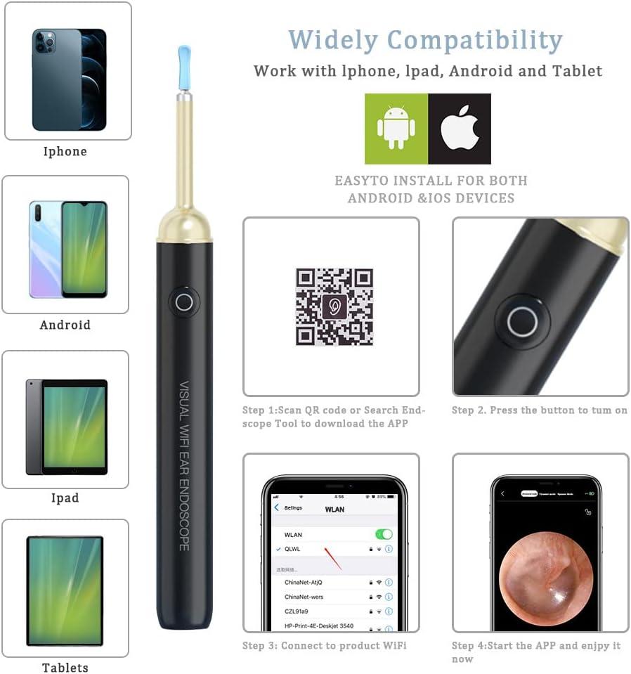 Wireless 1080P FHD Ear Wax Removal Tool Camera with LED | Smart Visual ...