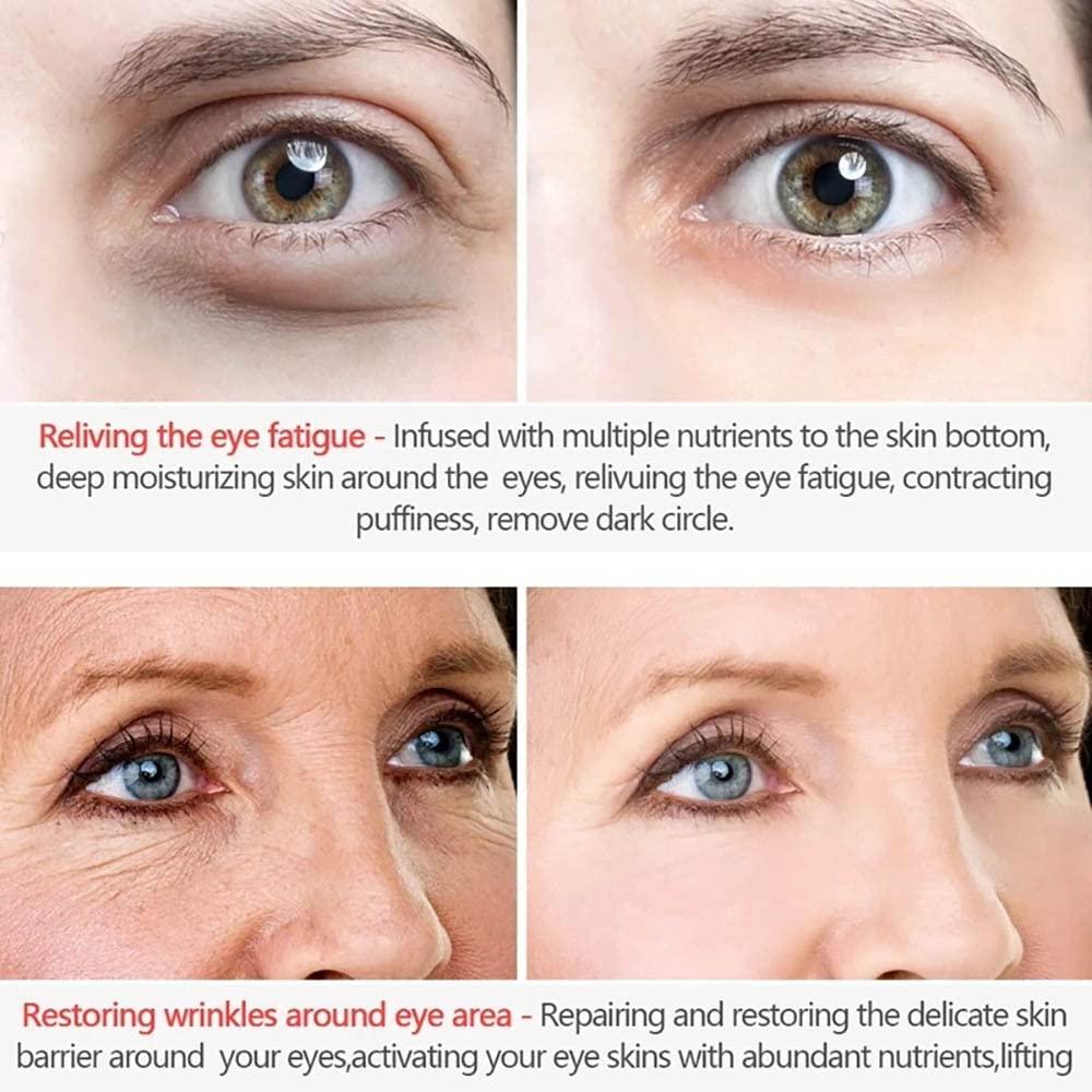 Magic Eye Cream - Anti Aging Treatment for Under Eye Bags, Wrinkles ...