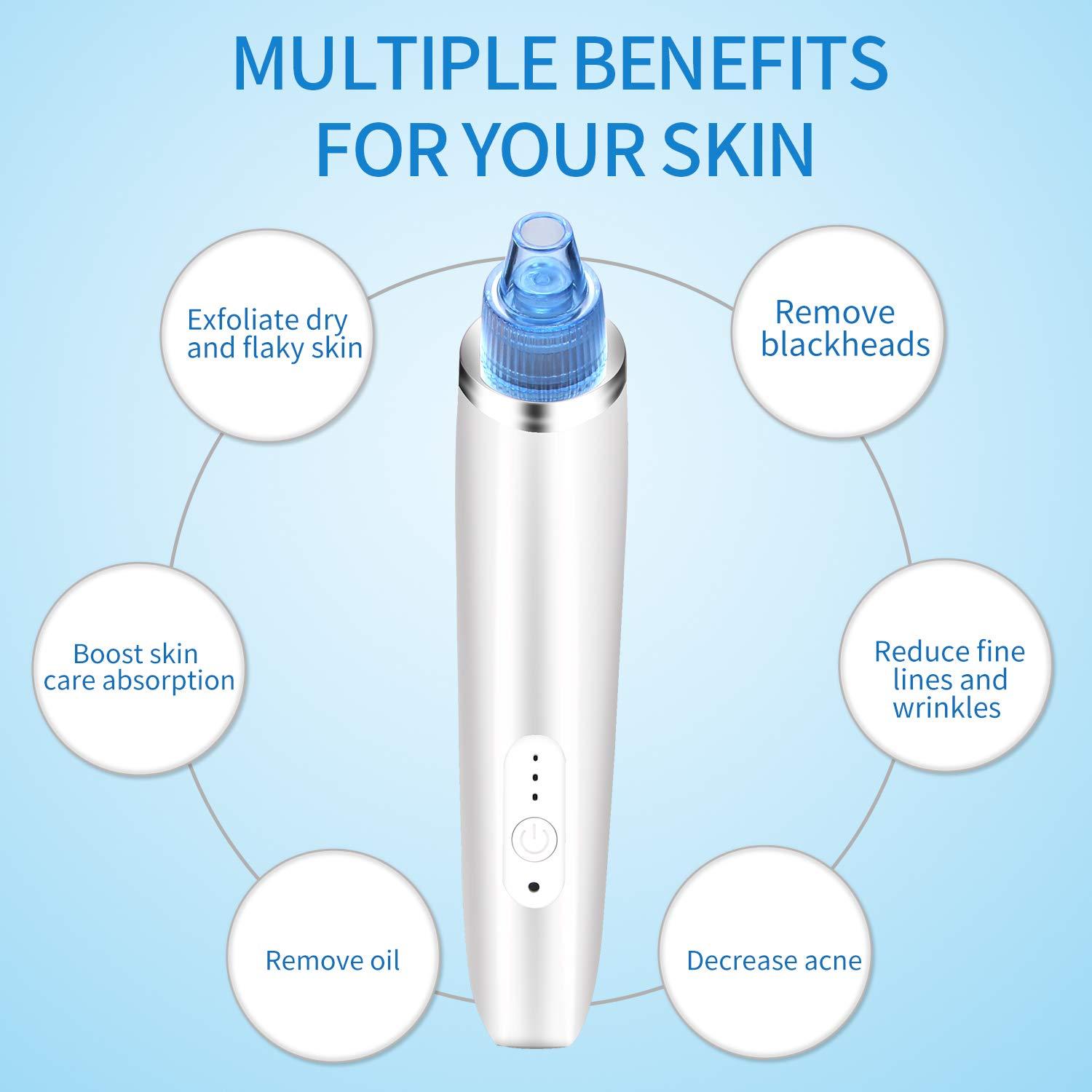 Pore Vacuum Blackhead Remover | Electric Facial Cleaner with Adjustable ...
