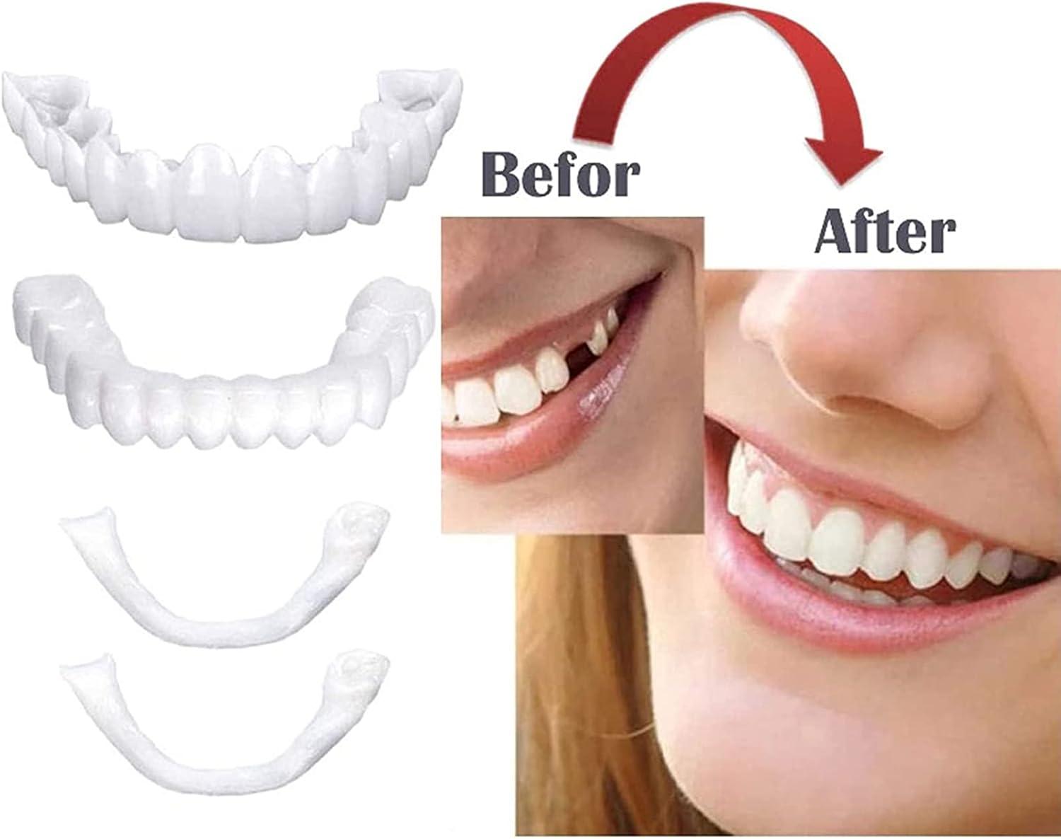 Buy WTTFC Extra Thin Teeth Veneers - Comfort Fit Dental Prosthesis for ...