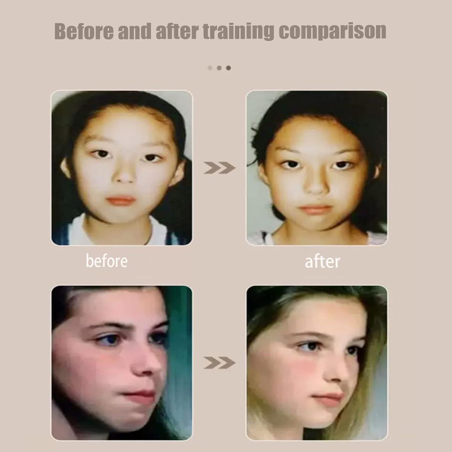 Anti Snoring Lip Muscle Trainer for Improved Breathing | Men, Women ...