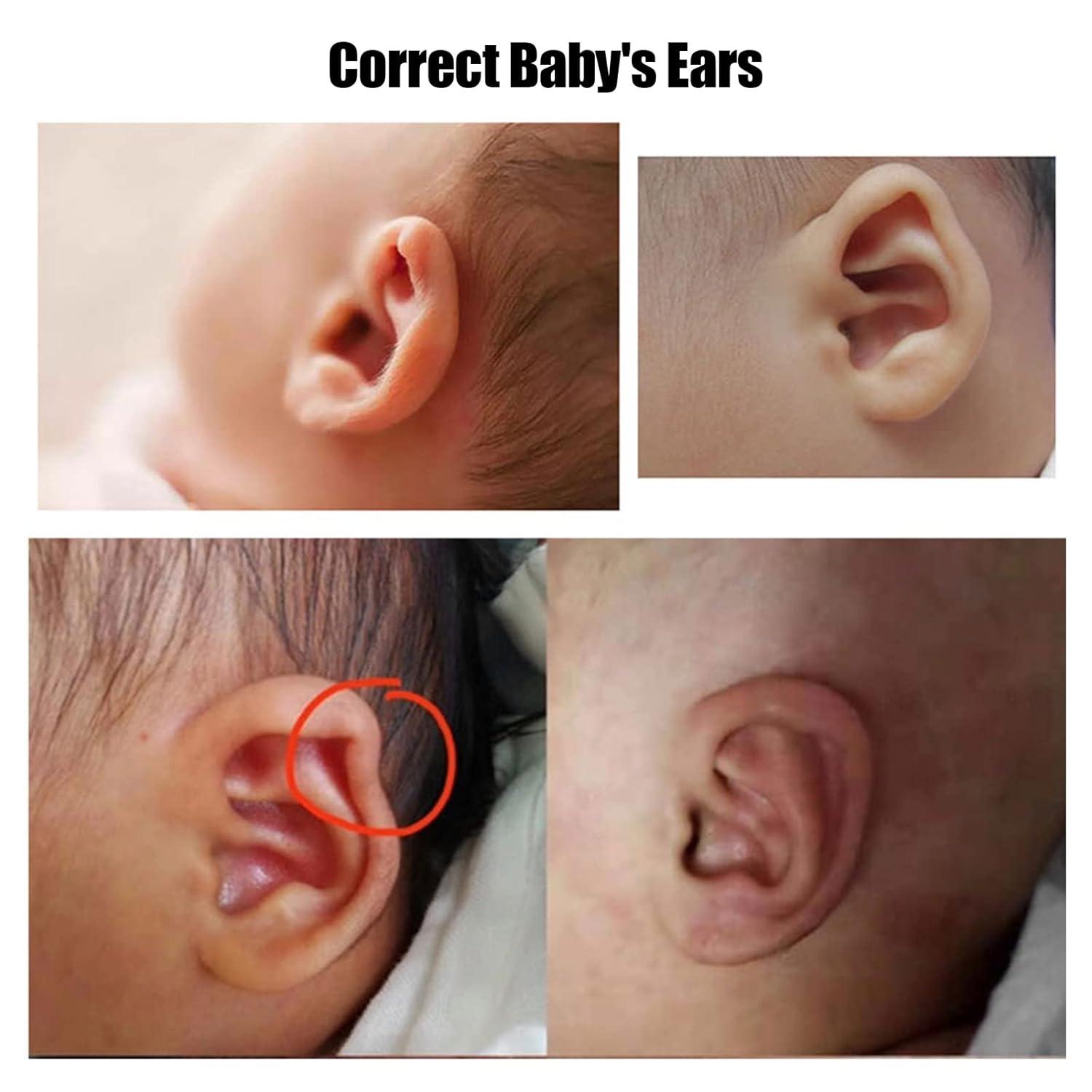 Silicone Protruding Ear Aesthetic Corrector for Newborns - Kids Infant ...