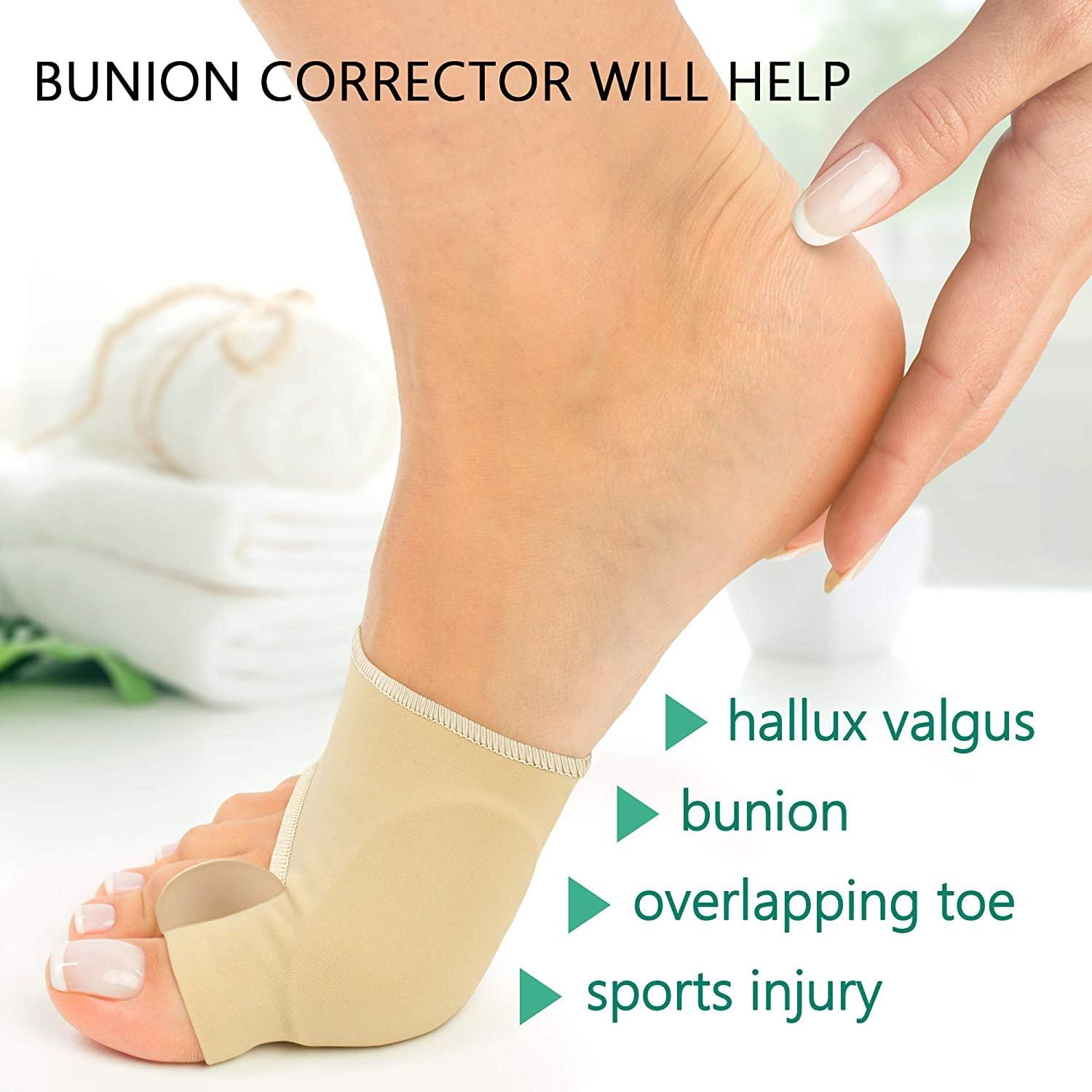 Orthopedic Bunion Corrector (2PCS) - Non-Surgical Hallux Valgus Splint ...