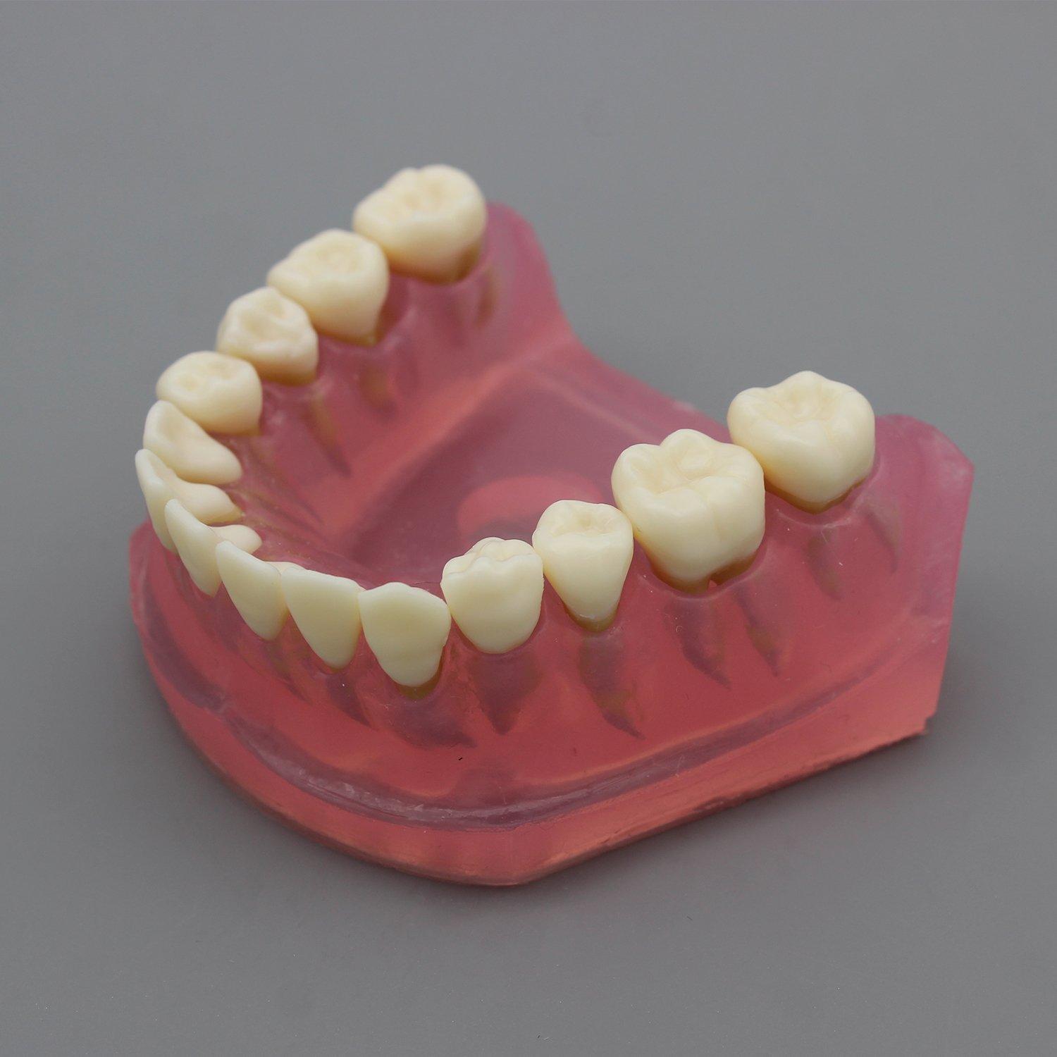 Dental Implant Teeth Model - Standard Study and Teaching Tool with ...