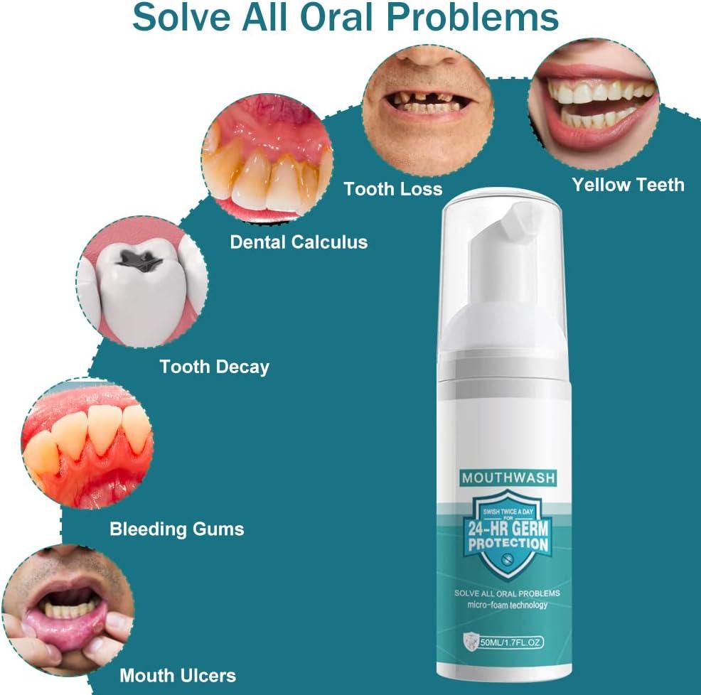 Natural Foam Toothpaste | Baking Powder Tooth Whitening Foam | Oral ...