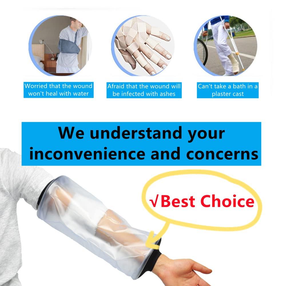 Waterproof Arm Cast Protector | Plaster & Bandage Sleeve for Showers ...