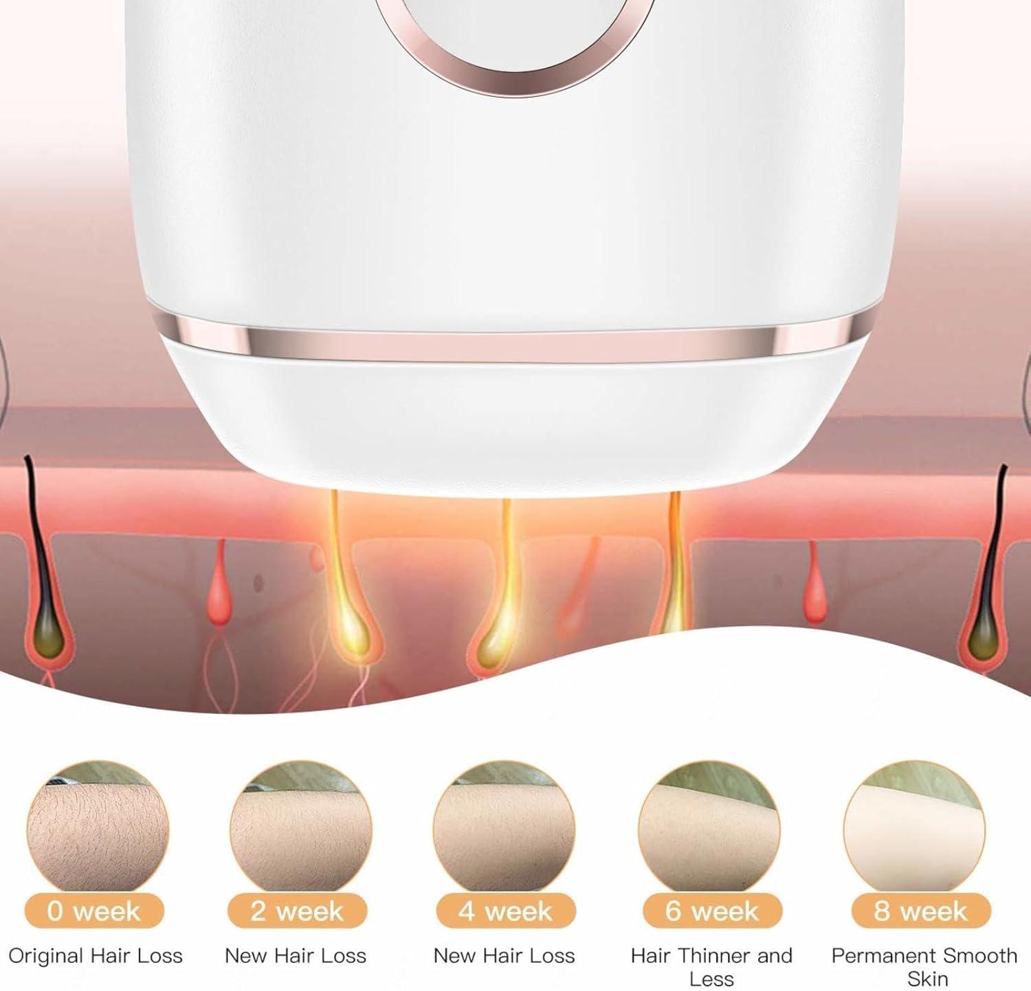 Gerrit IPL Hair Removal Laser - Full Body Depilation for Face Legs ...