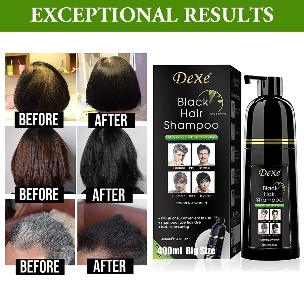 Dexe Instant Black Hair Shampoo 13.53 Fl Oz - Ammonia-Free 3-in-1 Hair ...