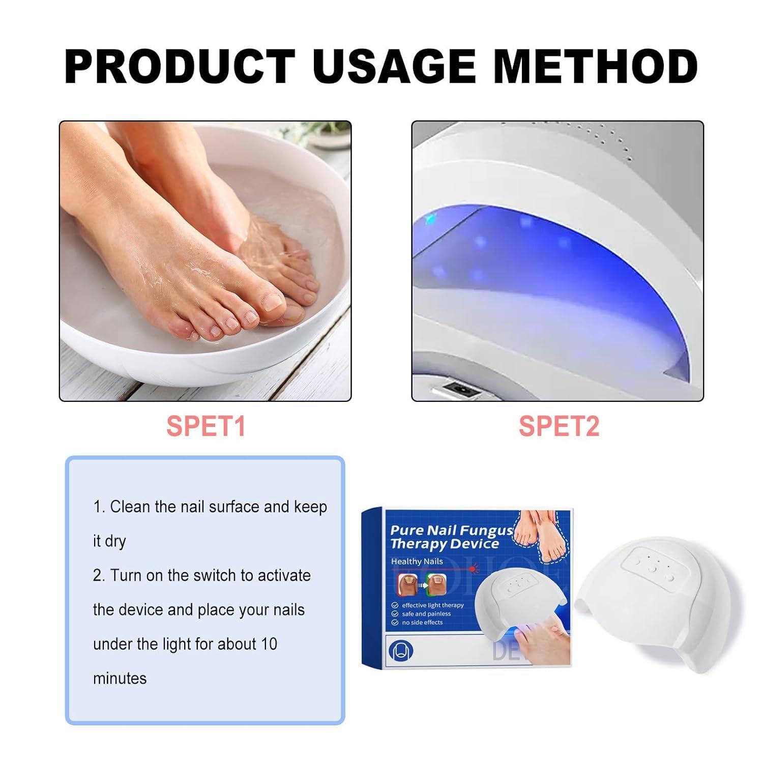 Furzero & Pureail Nail Fungus Laser Devices | Effective Fungal ...