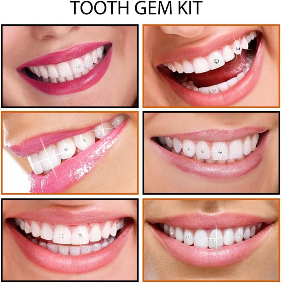 Tooth Gemstone Set - DIY Tooth Jewelry Kit with Glue & Light Hardening ...