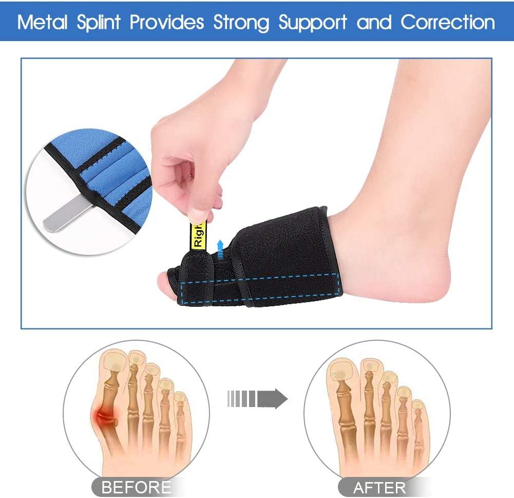 Night Sleep Bunion Corrector with Metal Splint Support - Toe ...