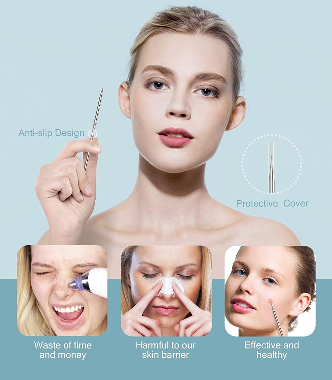 Upmore 6PCS Blackhead Remover Kit - Professional Stainless Acne ...