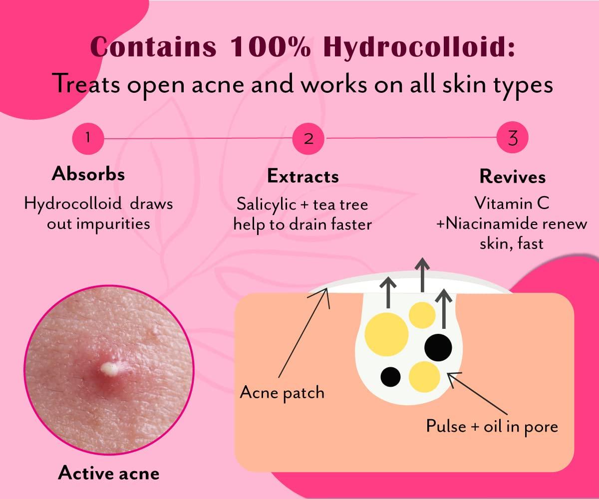 Buy Rectangular Pimple Patch - Effective Acne Treatment & Fast ...