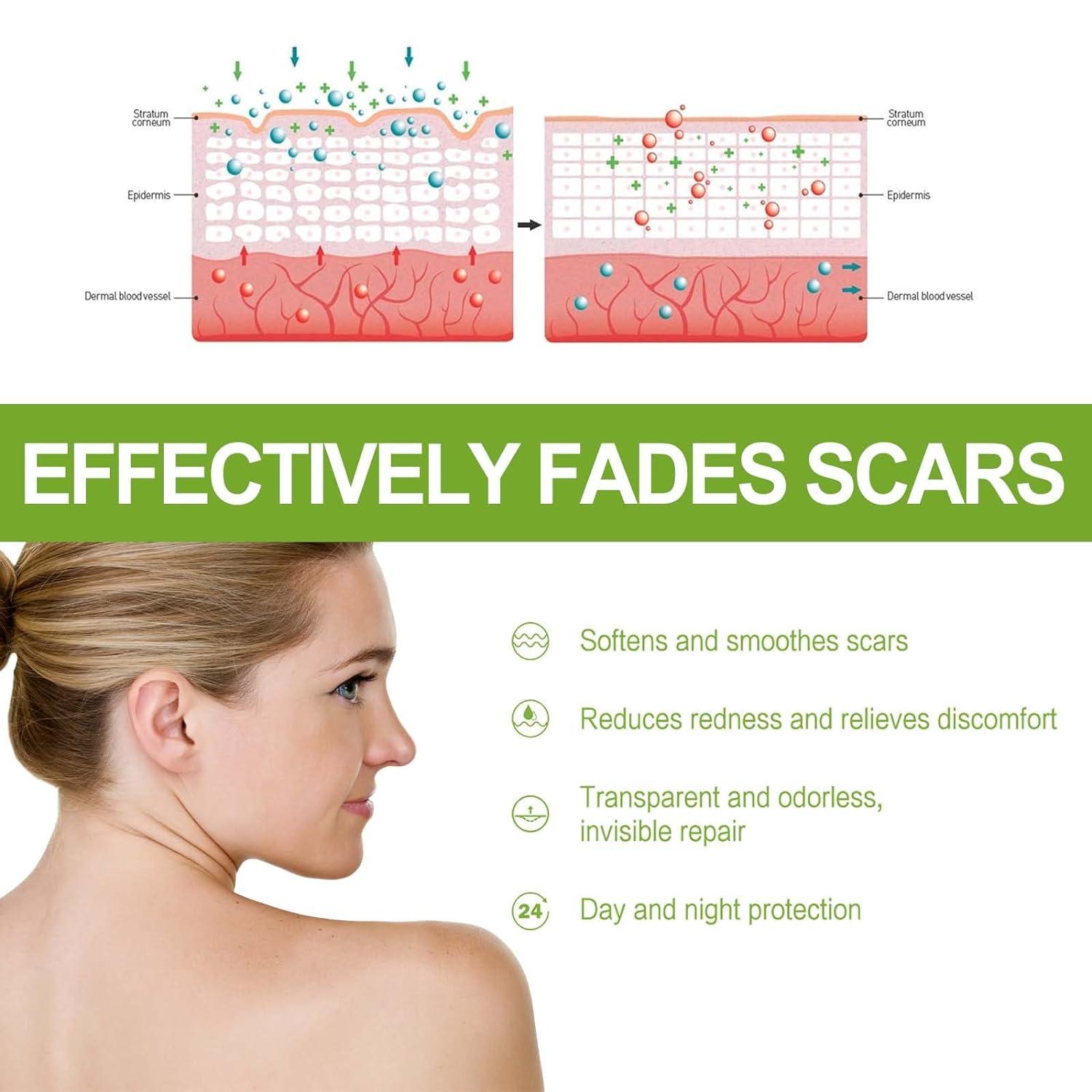 Scar Repair Serum - Nature's Treatment for All Types of Scars - 30ml ...