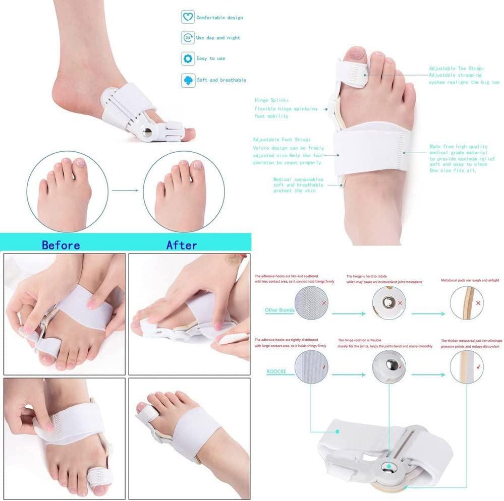 CN Herb Toe Corrector Big Foot Bone Day and Night with Mu Valgus ...