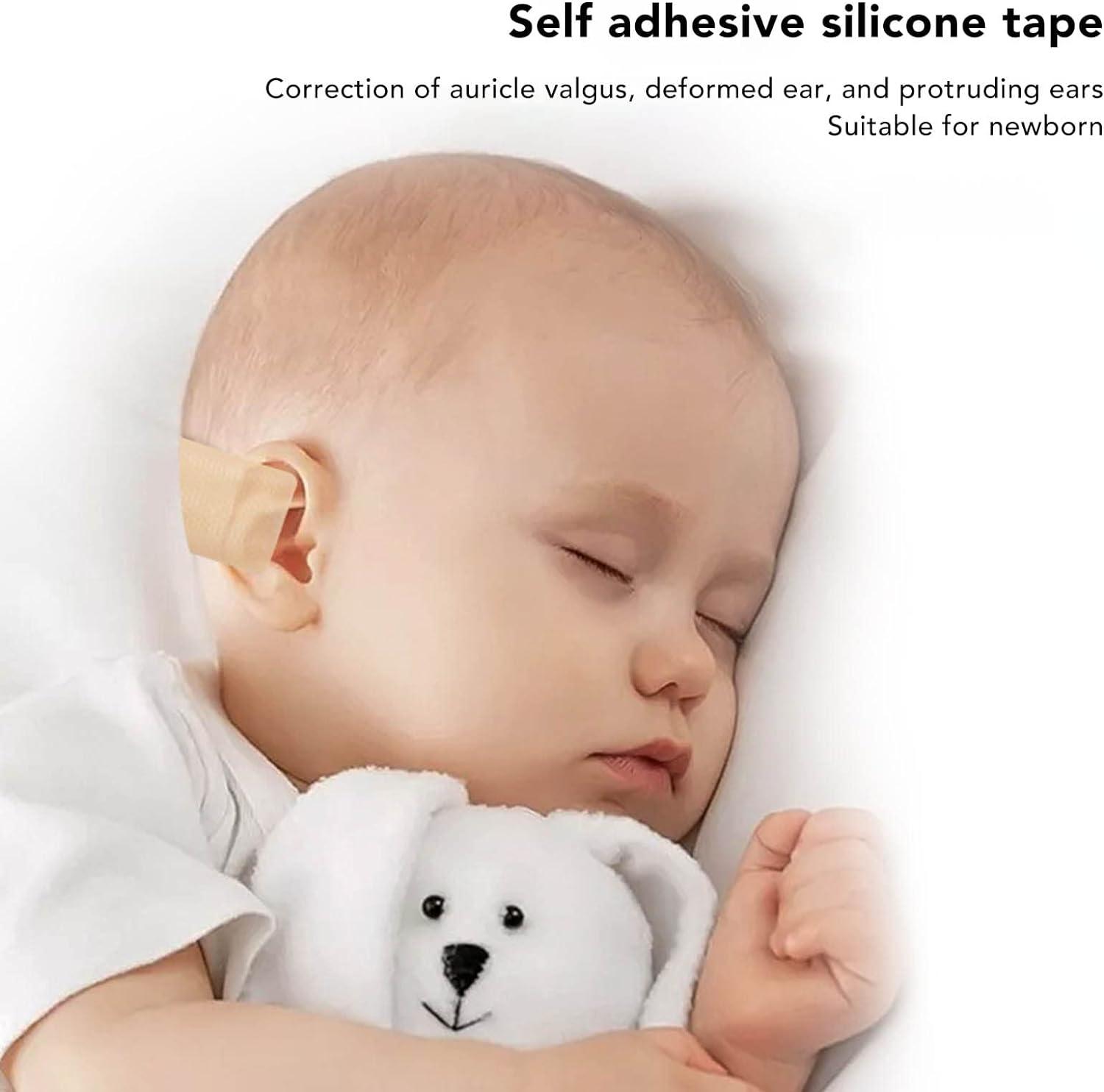 Silicone Baby Ear Correction Patch Kids & Infants Auricle Valgus Corrector