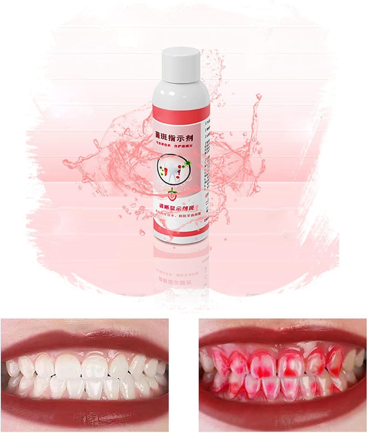 Buy Dental Indicator Fluid - Enhance Oral Health & Improve Brushing ...