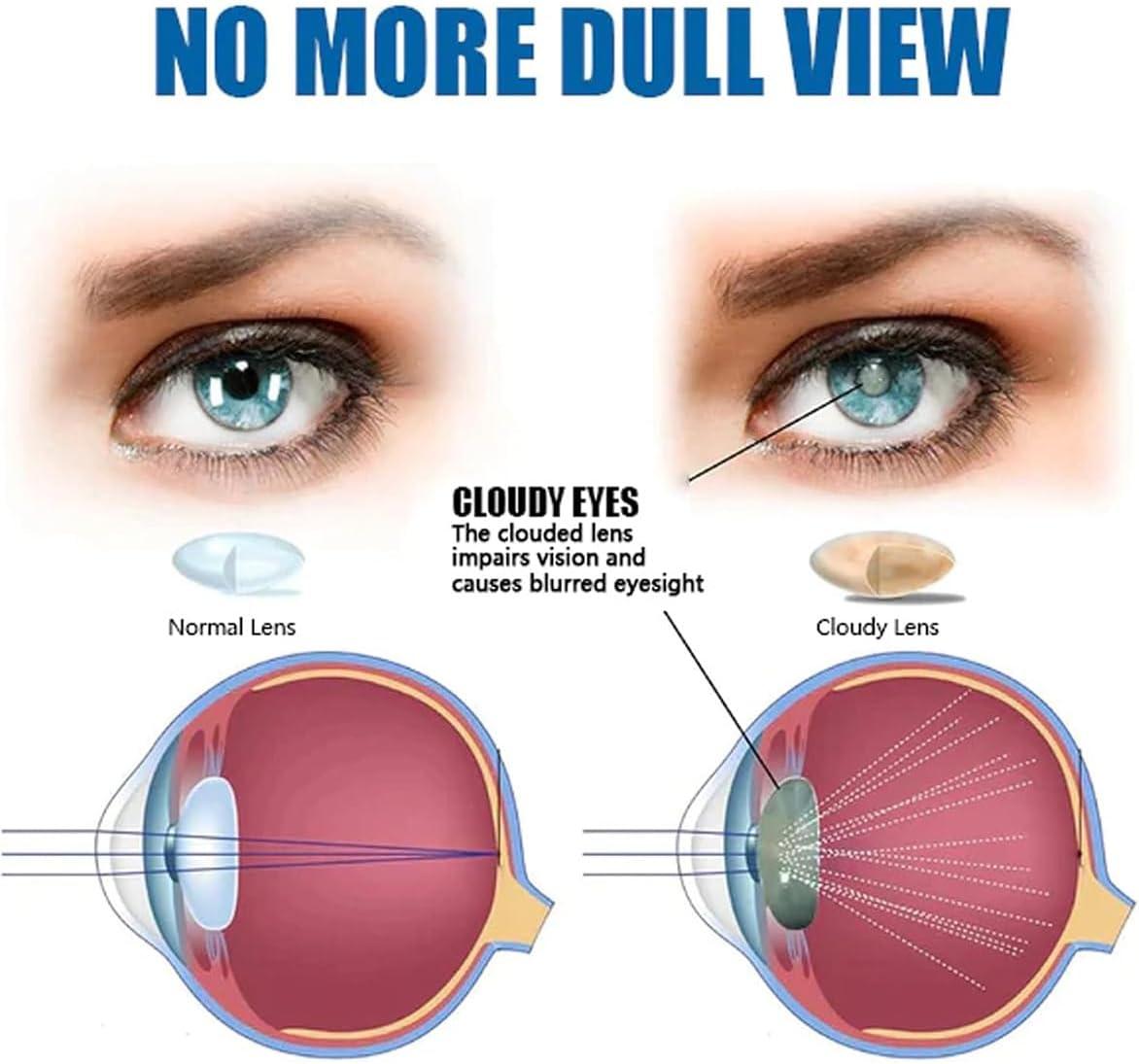 Myopia Reversal Eye Drops | Brightening & Relief for Dry Eyes Fatigue ...