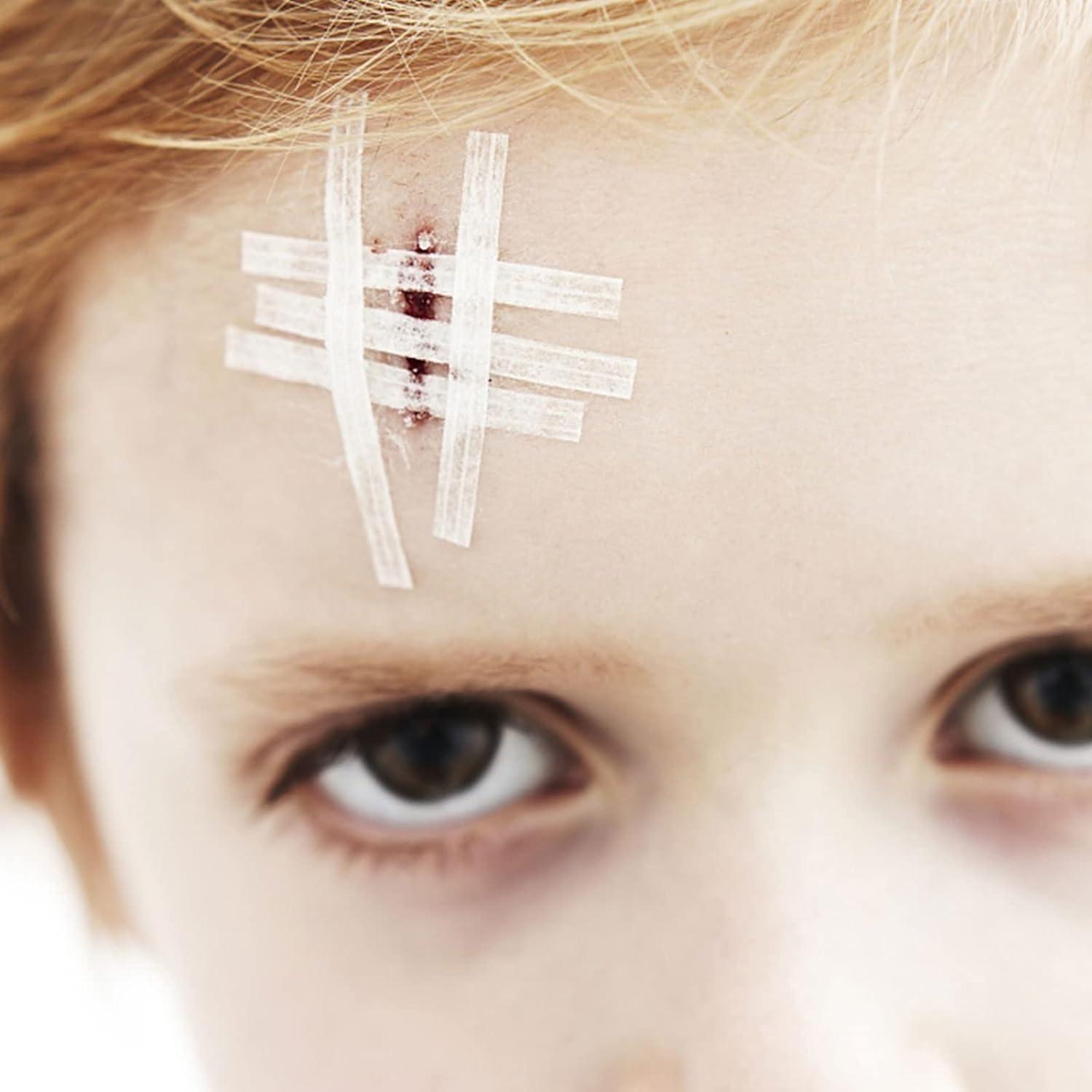 2 Rolls Micropore Surgical Tape 1.25cm X 9.1m - First Aid Medical ...