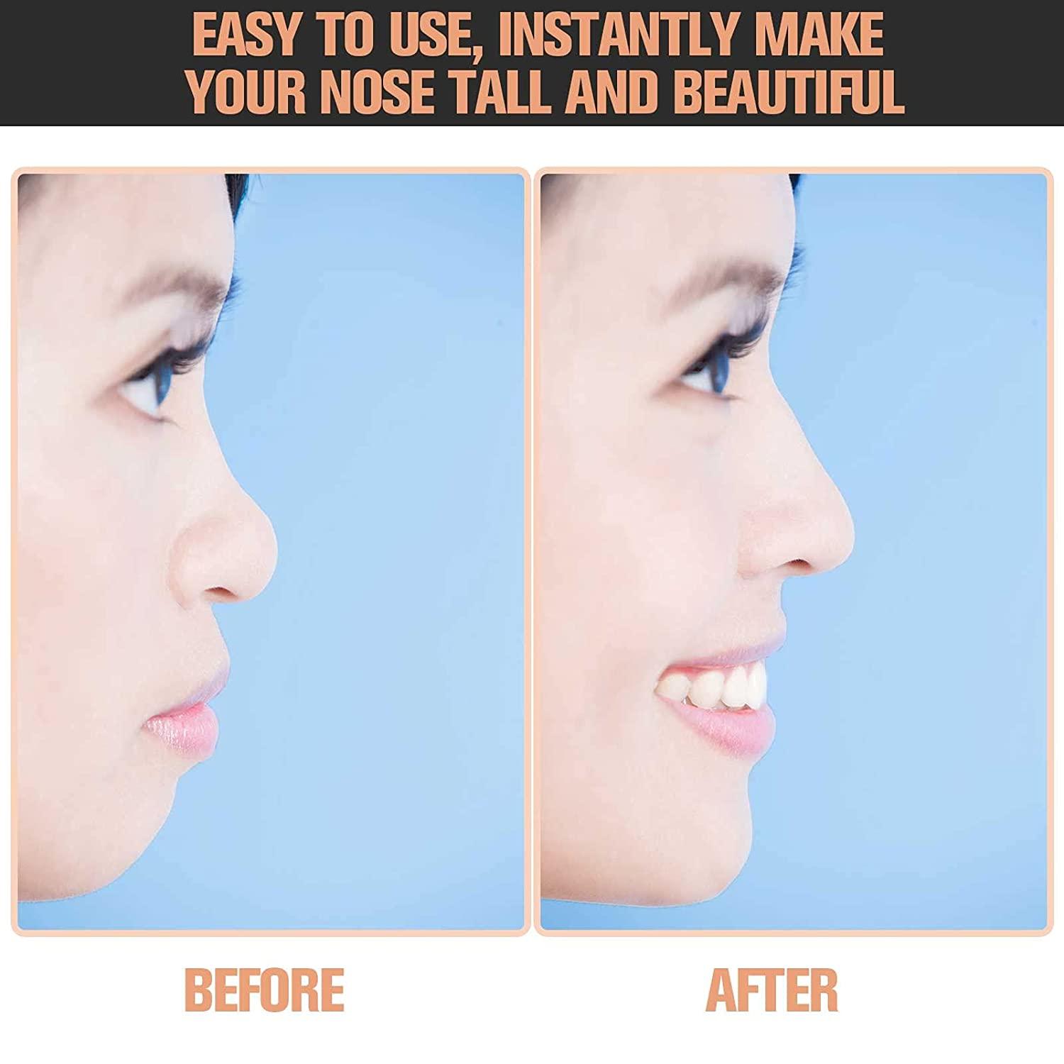 2 Sets Nose Up Lifting Shaper Clips - Silicone Nose Shaper Inserts for ...