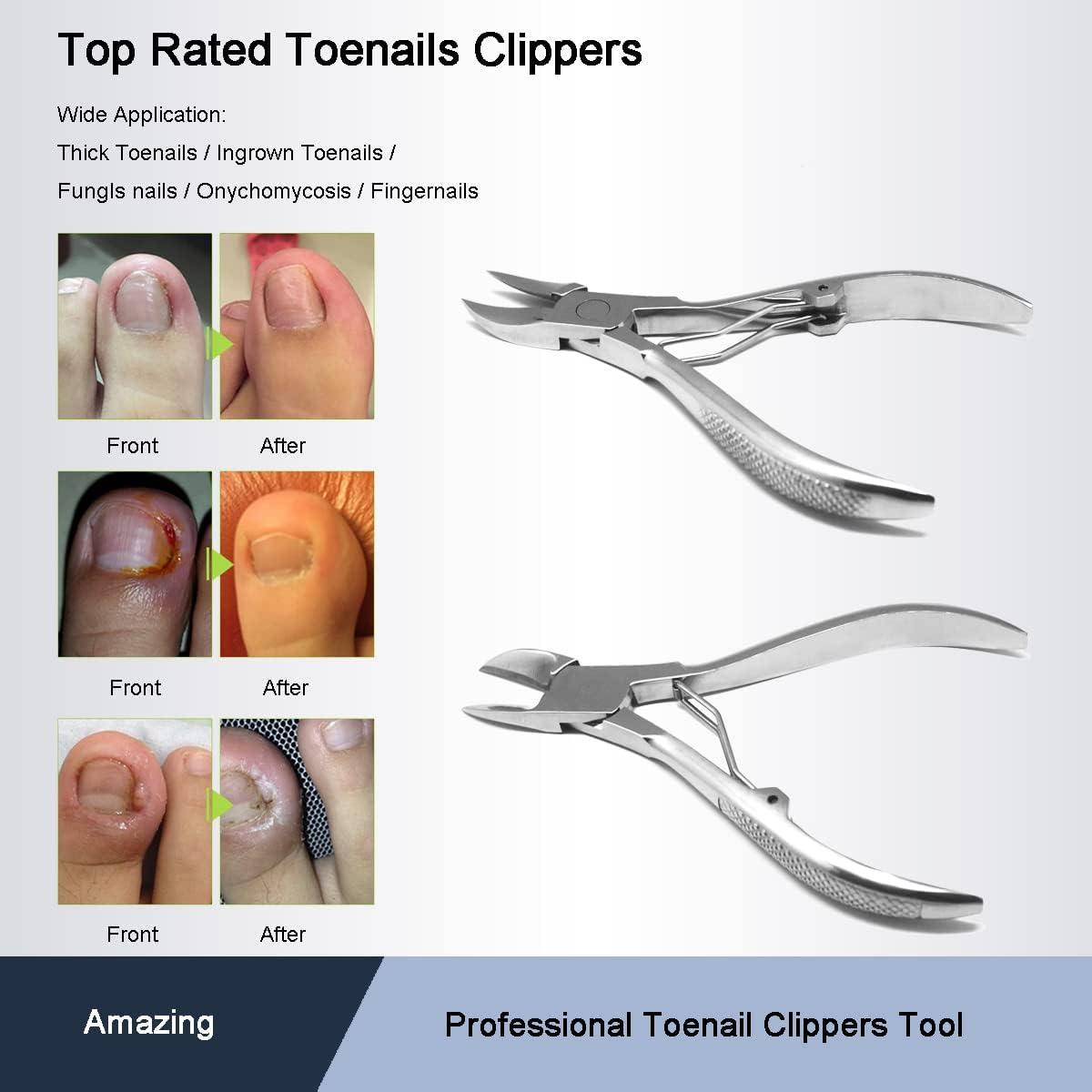 Stainless Steel Toenail Clippers For Thick Or Ingrown Nails Heavy