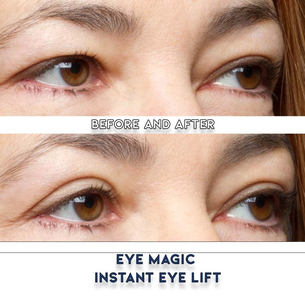 Eye Magic Premium Instant Eyelid Lift (L/XL Kit w/Gel) | Lifts Droopy ...
