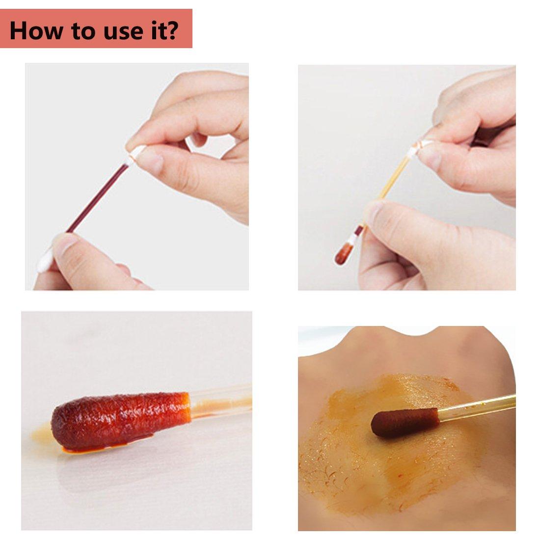 UBae 100pcs Disposable Medical Iodine Swab for Wound Care ...